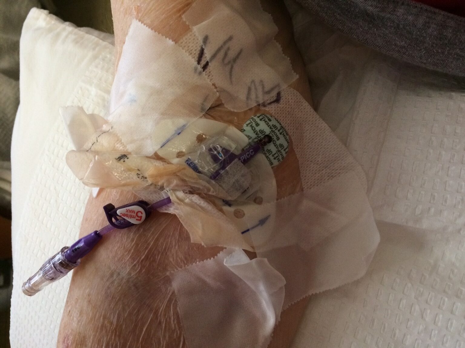 Vascular Dressing Wear Time: The Gap between Guidelines and Practices ...