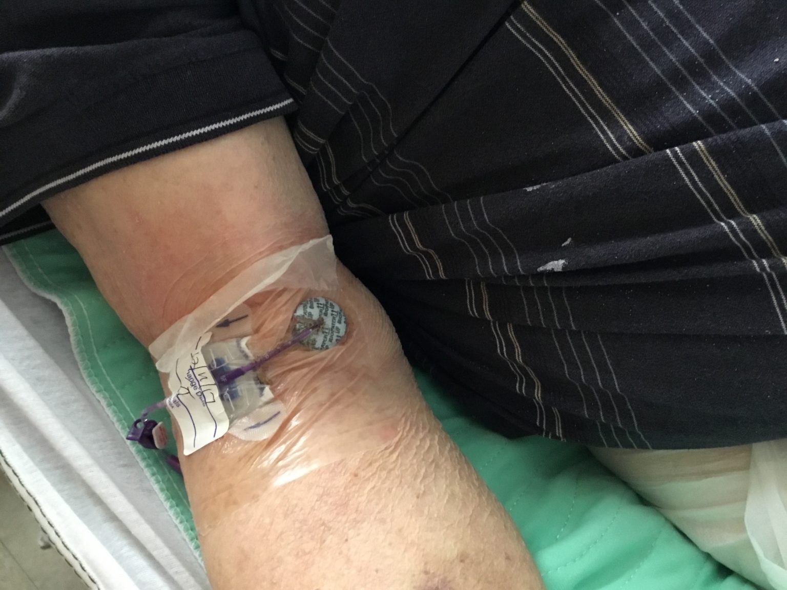 Device and Dressing Securement: Updated Practice Recommendations in the ...