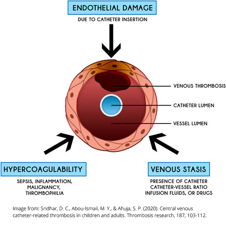 Pathway to Patency: Exploring the Challenges to Catheter Patency and ...