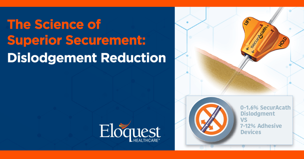 The Science of Superior Securement: Dislodgement Reduction – Eloquest Healthcare, Inc.